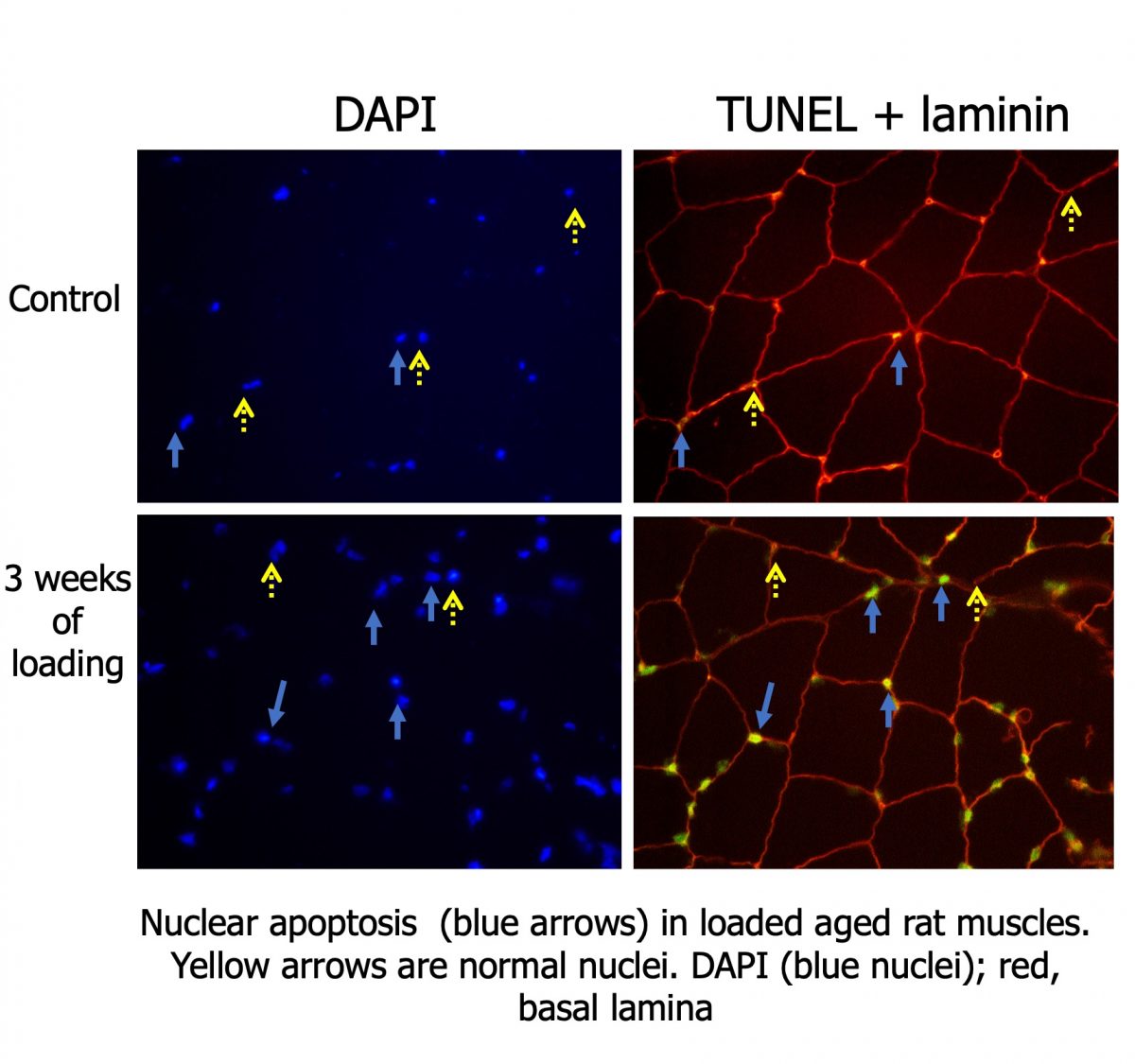 Research Areas – Laboratory of Muscle Biology and Sarcopenia