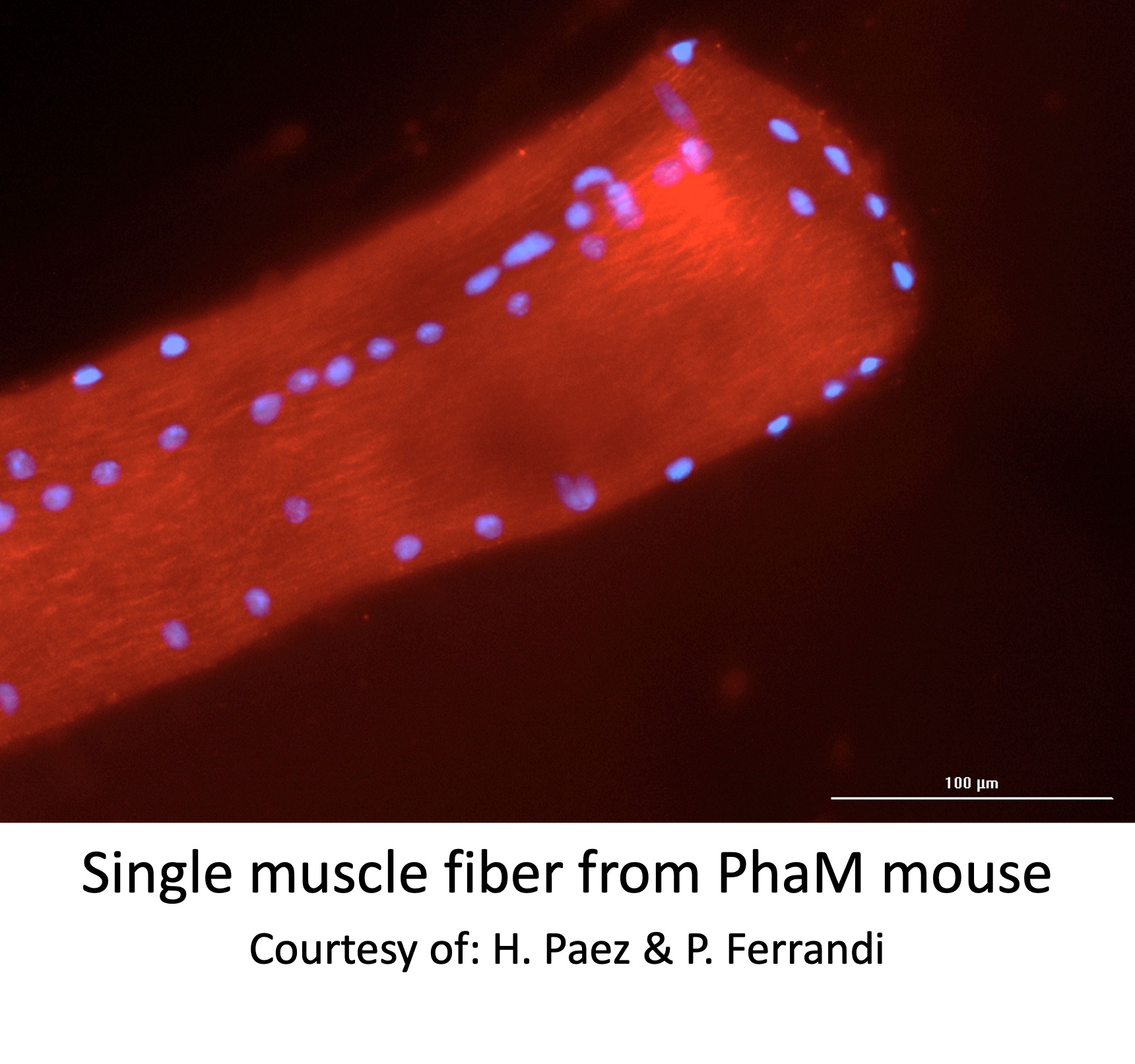 Research Areas – Laboratory of Muscle Biology and Sarcopenia